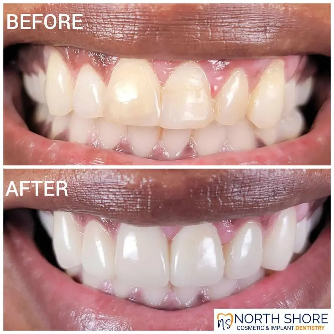 ePac Flexible Packaging Introduces New Easy Open Barrier Films for Coffee Brands - The Oklahoman